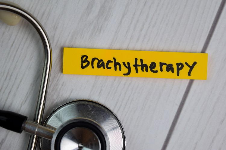Brachytherapy to Treat Cancer: A Targeted and Effective Approach ...